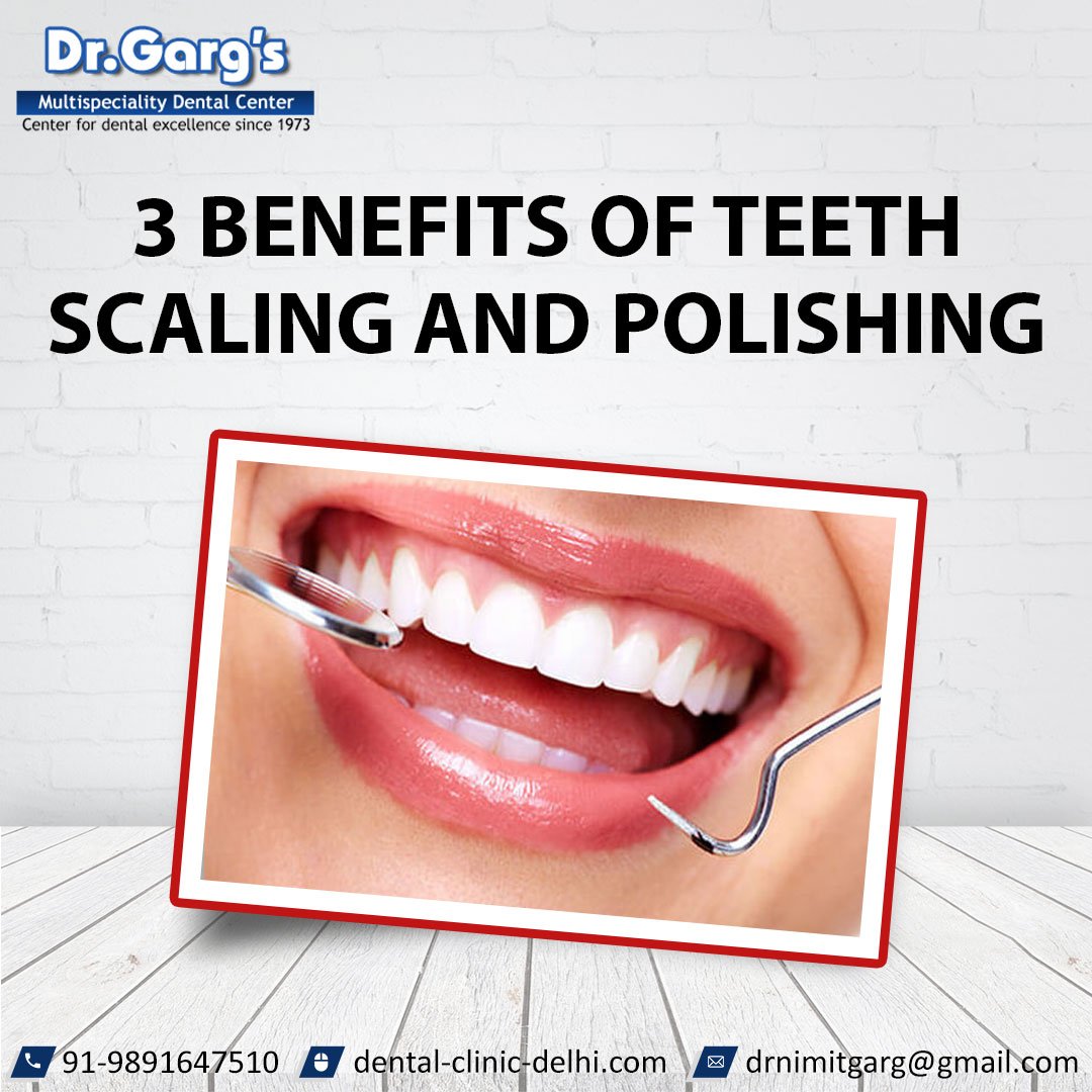 3 Benefits of Teeth Scaling and Polishing